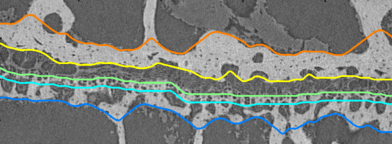 Layered Surface Detection – QIM